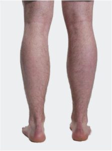 Legg/ankel/fot – BevApp