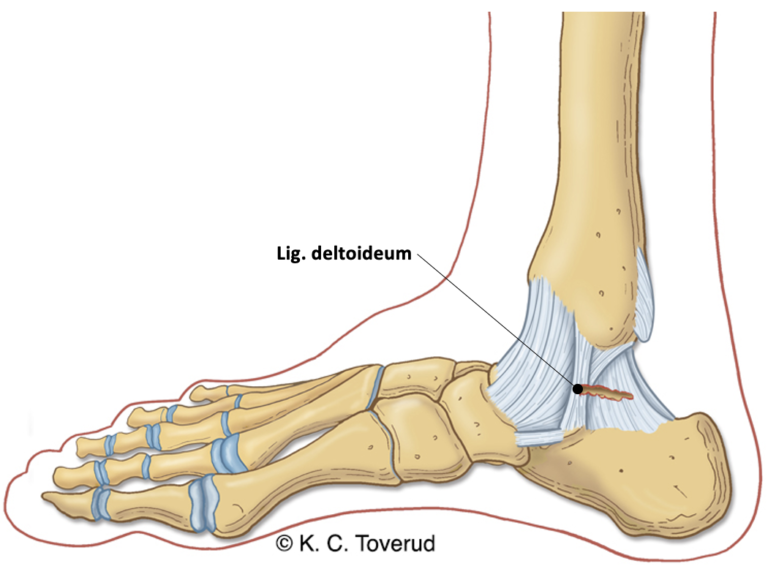 Ligamentskade ankel – BevApp
