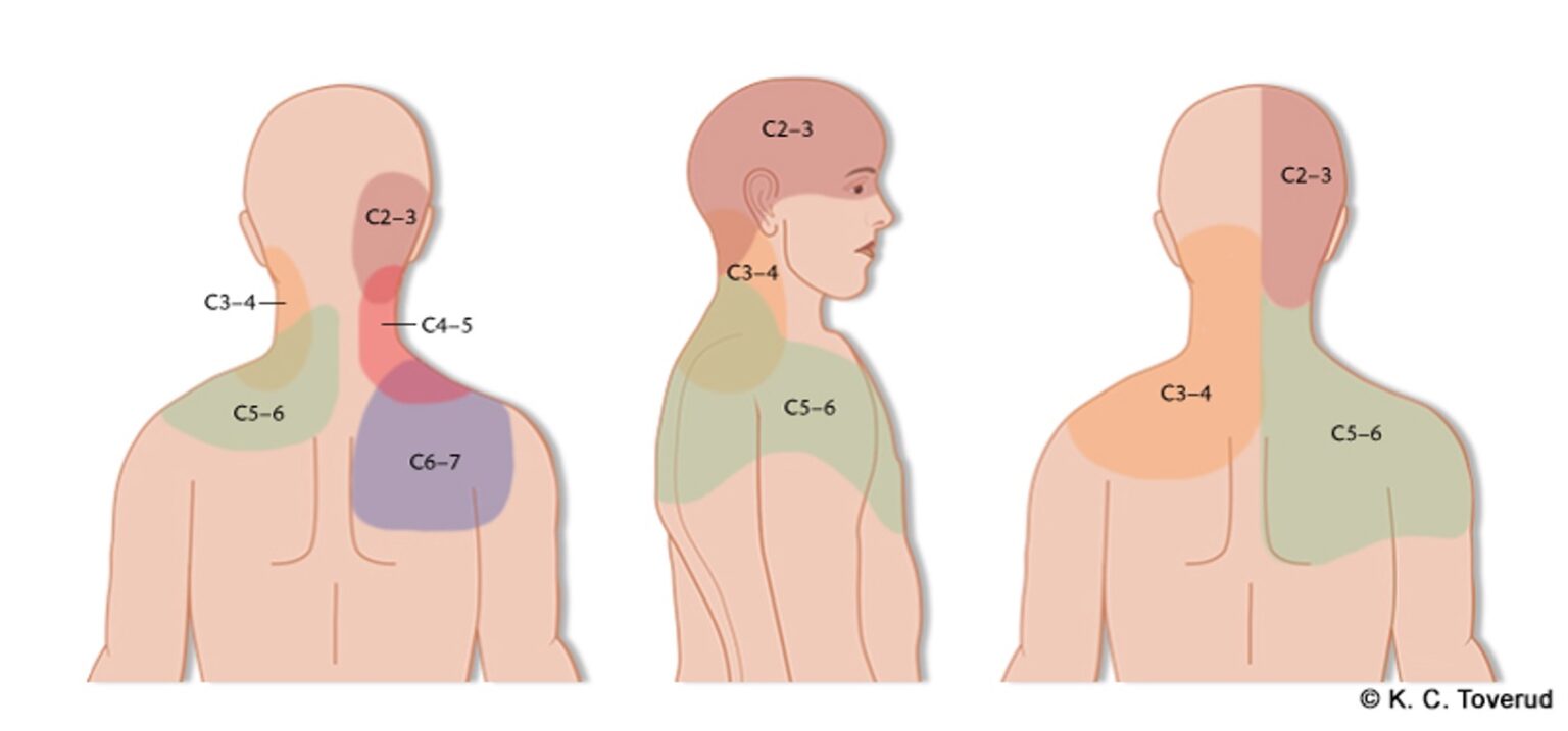 Introduksjon til BevApp – BevApp